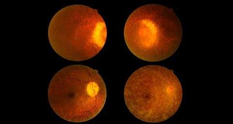 Home - Allee Vision Optometrist